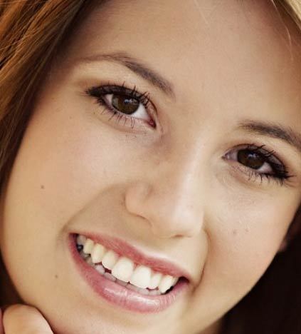 Fatete dentare – pentru un zambet perfect - Elle.ro