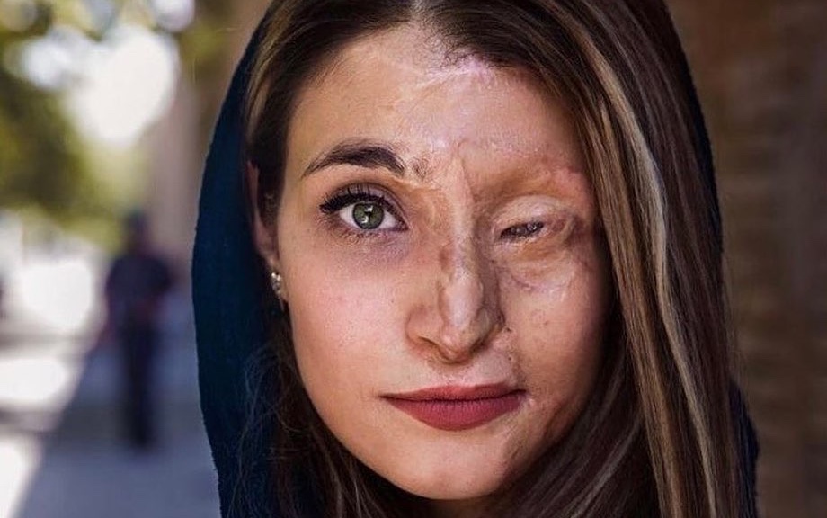 Marziyeh Ebrahimi și drumul de la victimă la luptătoare - Elle.ro