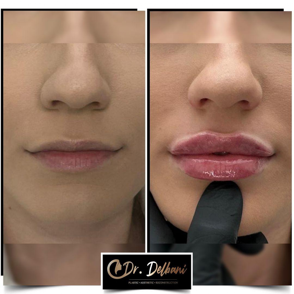 Secretul unui aspect tânăr și natural. Cum alegeți corect tratamentele ...